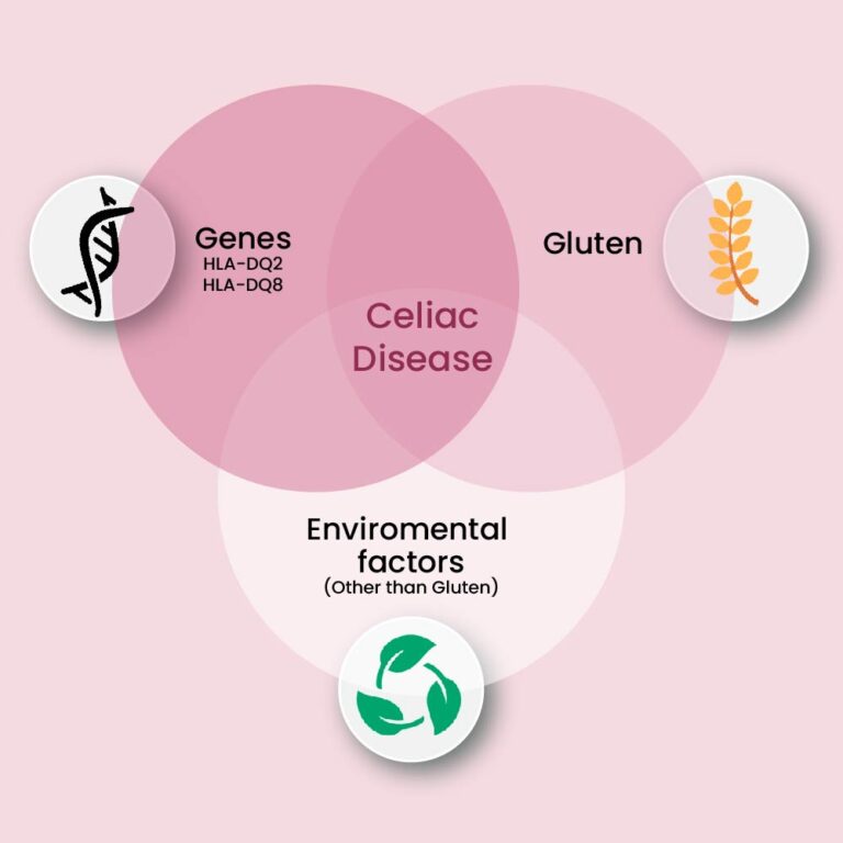 What causes Celiac? – Ease Celiac Disease